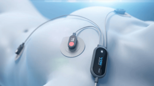 ViSi Mobile: Vital Sign Monitoring For Ambulatory Hospital Patients