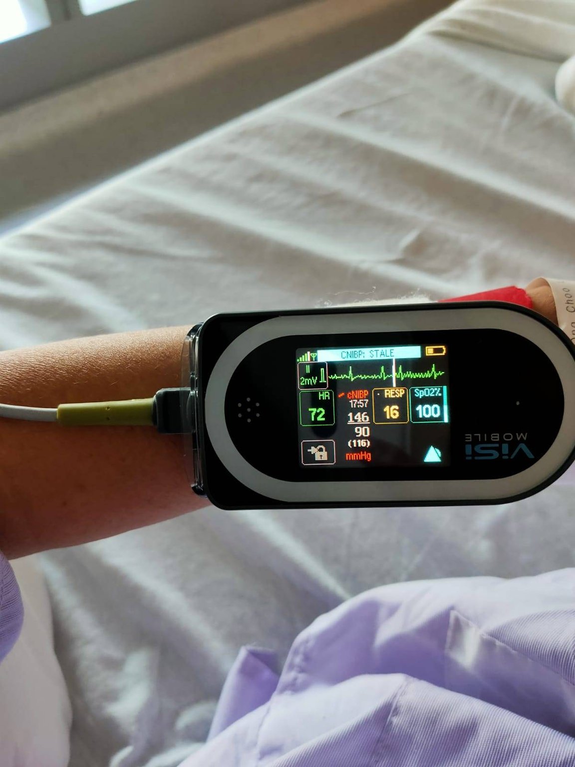 Infectious Disease – How ViSi Mobile Can Help