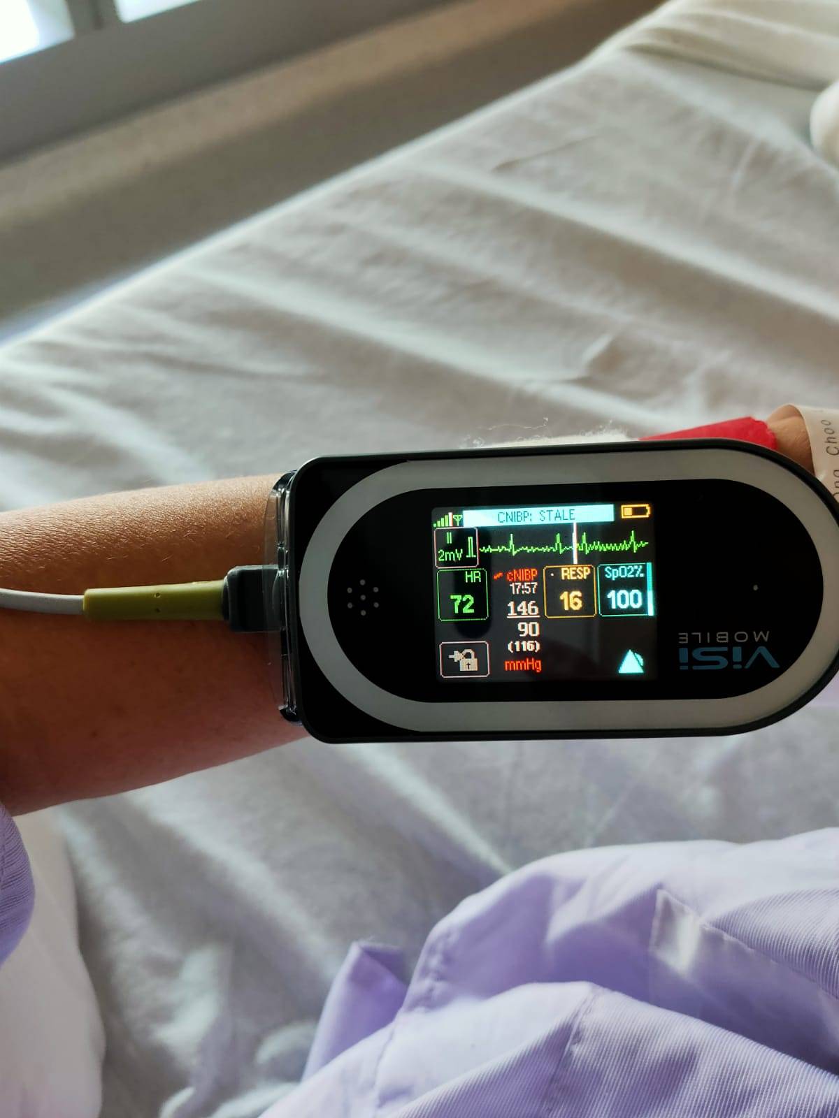 Infectious Disease – How ViSi Mobile Can Help