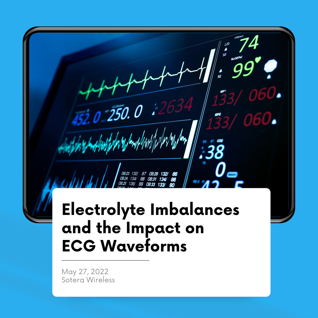 Electrolyte Imbalances and the Impact on ECG Waveforms