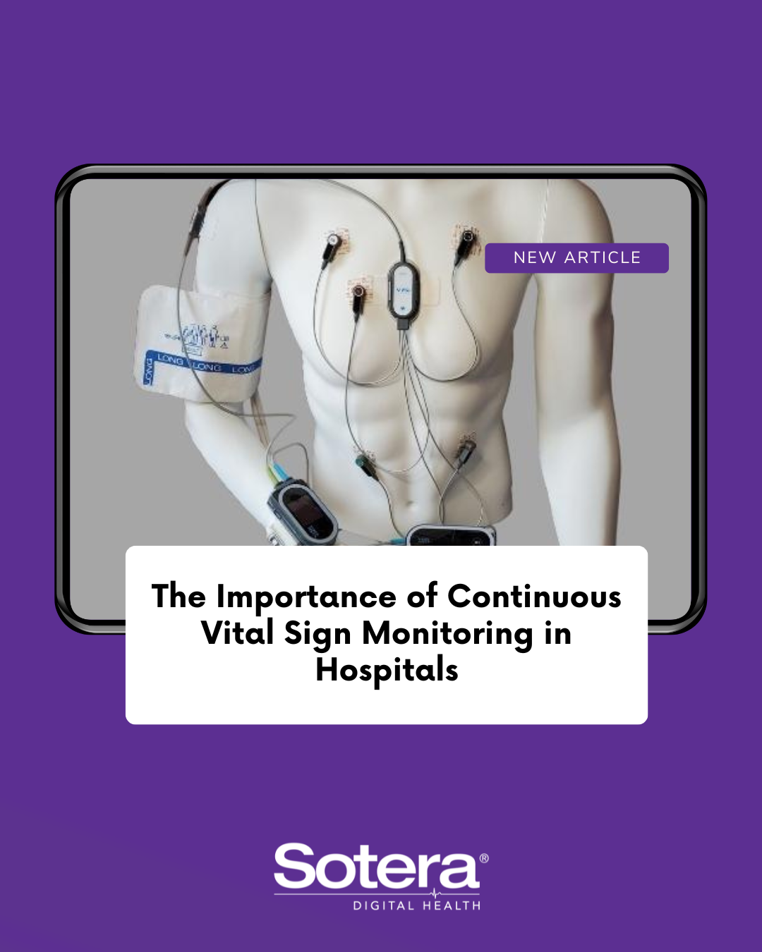 The Importance of Continuous Vital Sign Monitoring in Hospitals